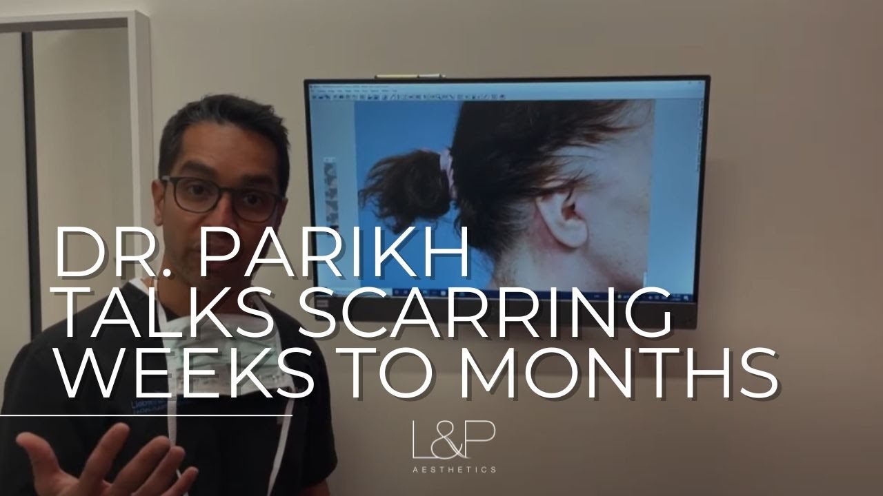 Dr. Parikh talks Bay Area Facelift Scarring Weeks to Months | L&P ...