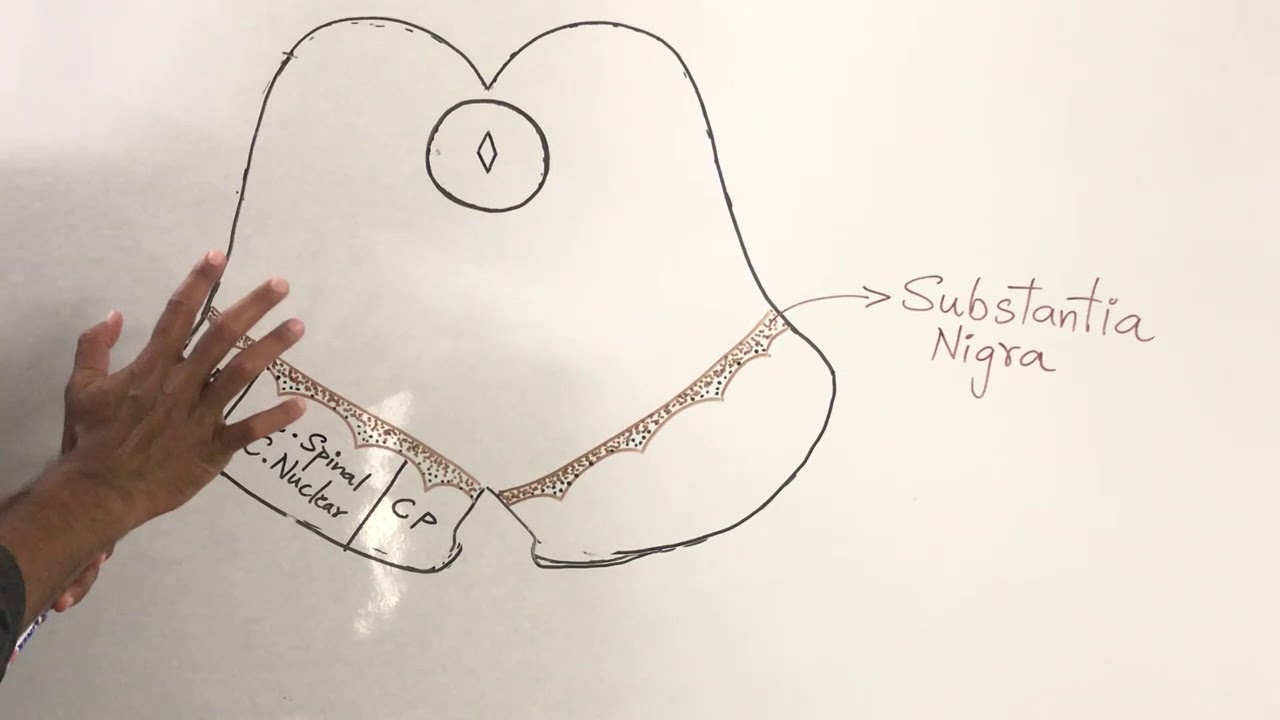Midbrain at the level of superior colliculus (Explained) - YouTube