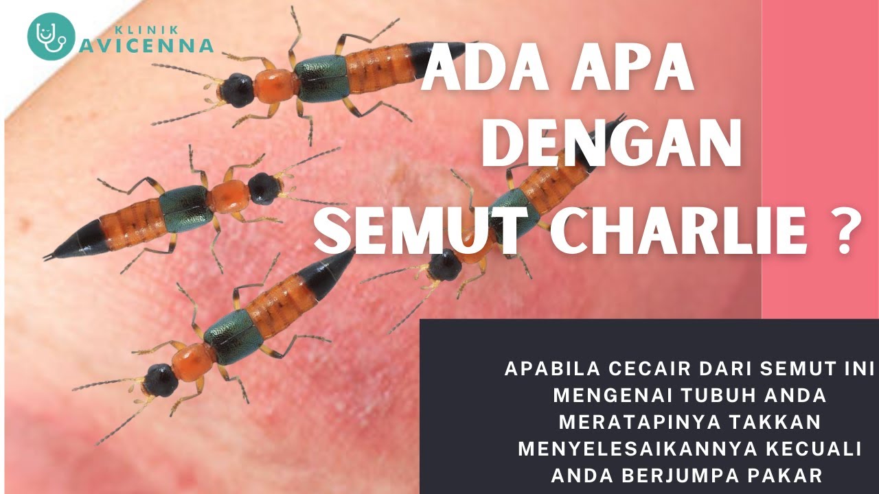 Ada Apa Dengan Semut Charlie ni ? Adakah Bahaya ? - YouTube