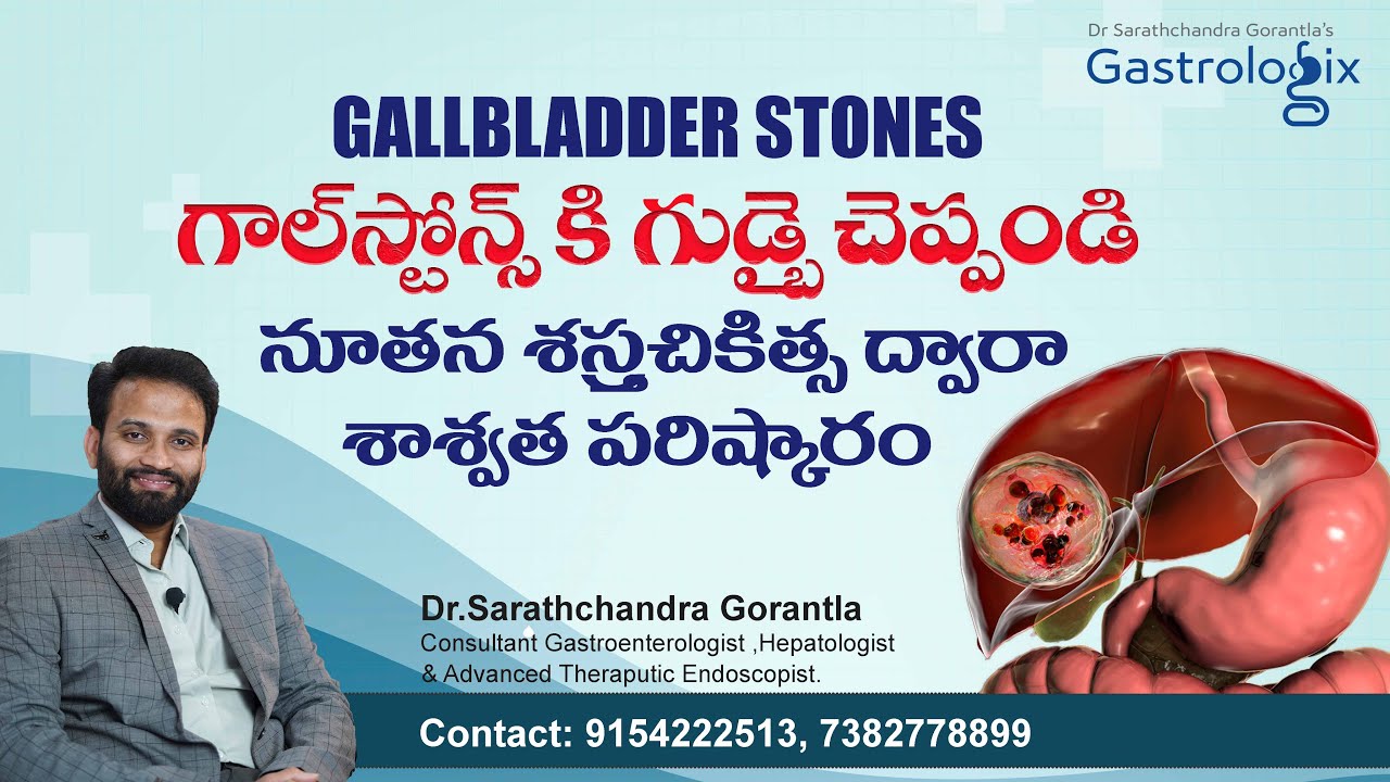 Goodbye to Gallbladder stone, Discover the Latest Surgical Solutions ...