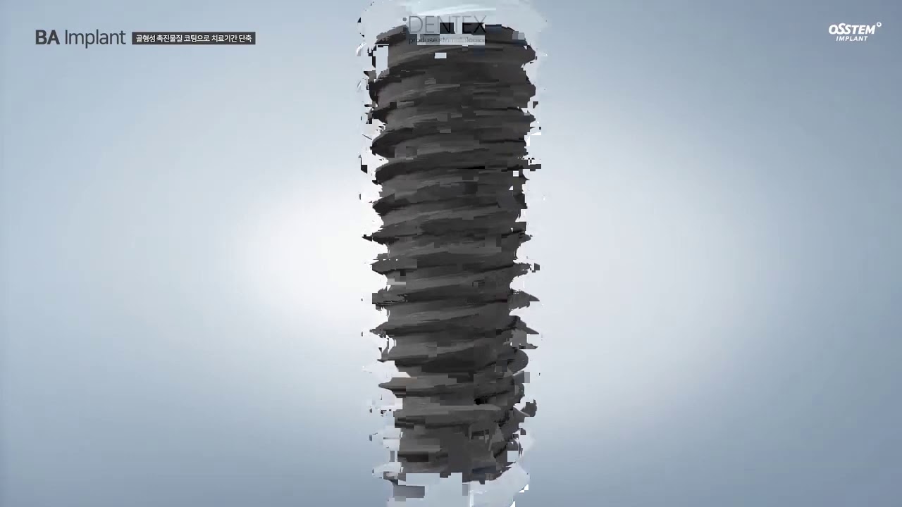Suprafeta inovativa a implantului OSSTEM BA sau HIOSSEN NH - YouTube
