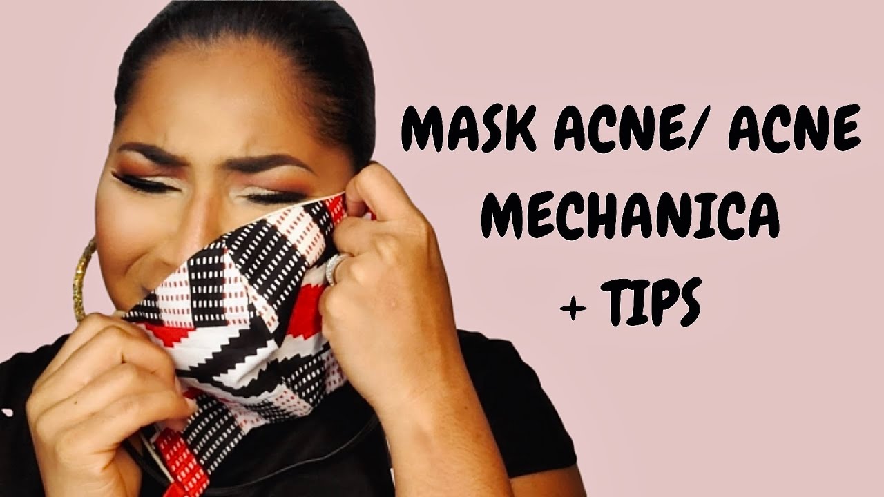 Mask Acne / Acne Mechanica + Tips |Sheri Approved - YouTube
