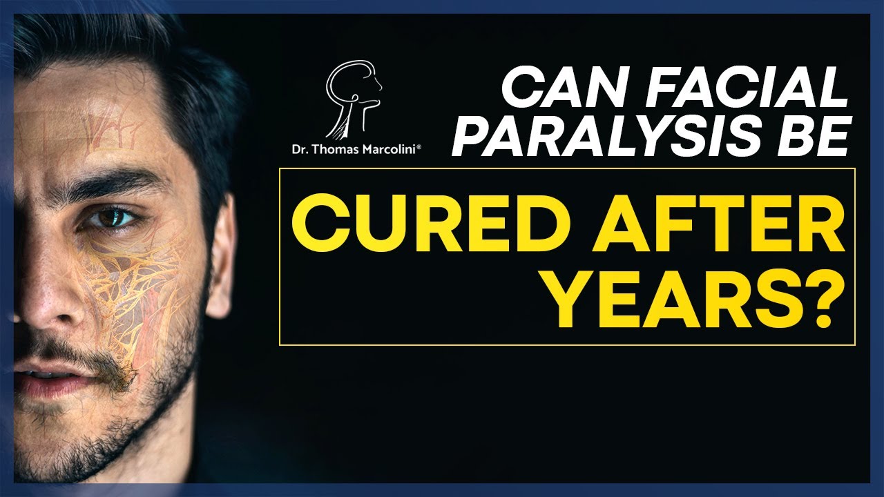 Bell's Facial Paralysis Surgery: Recovery and Long-term Results - YouTube