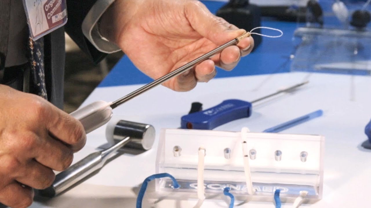 ICSES 2019 - Demostración y Técnica de Uso TenoLok™ por el Dr. Gonzalo ...