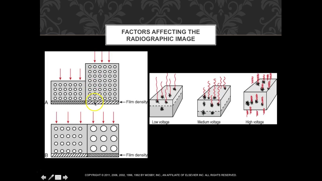 RADT 110 Conventional and Digital Imaging - YouTube