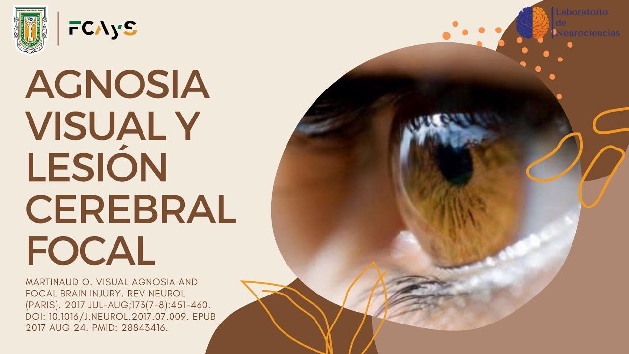 Agnosia Visual y Lesión Cerebral Focal - YouTube