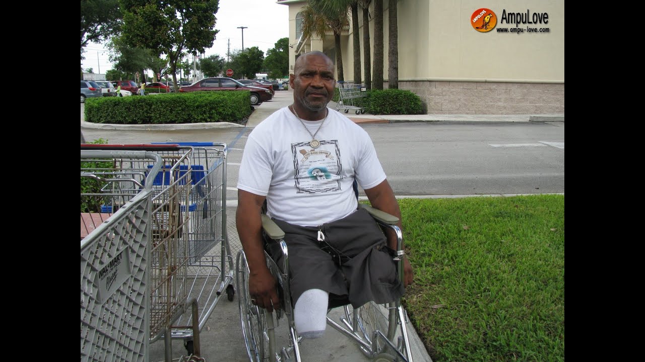 Amputee Kenneth above and below the knee from Fort Lauderdale, USA ...