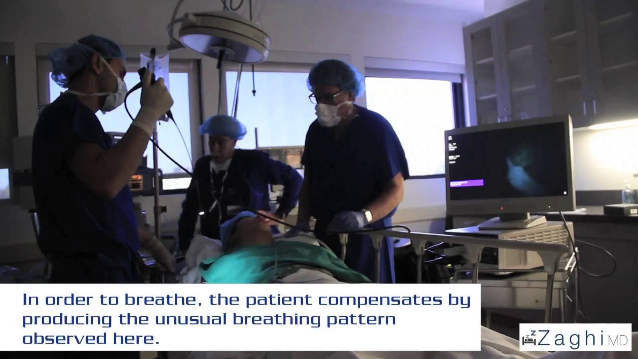 Drug Induced Sleep Endoscopy - Case Study 1 - Dr. Soroush Zaghi - YouTube