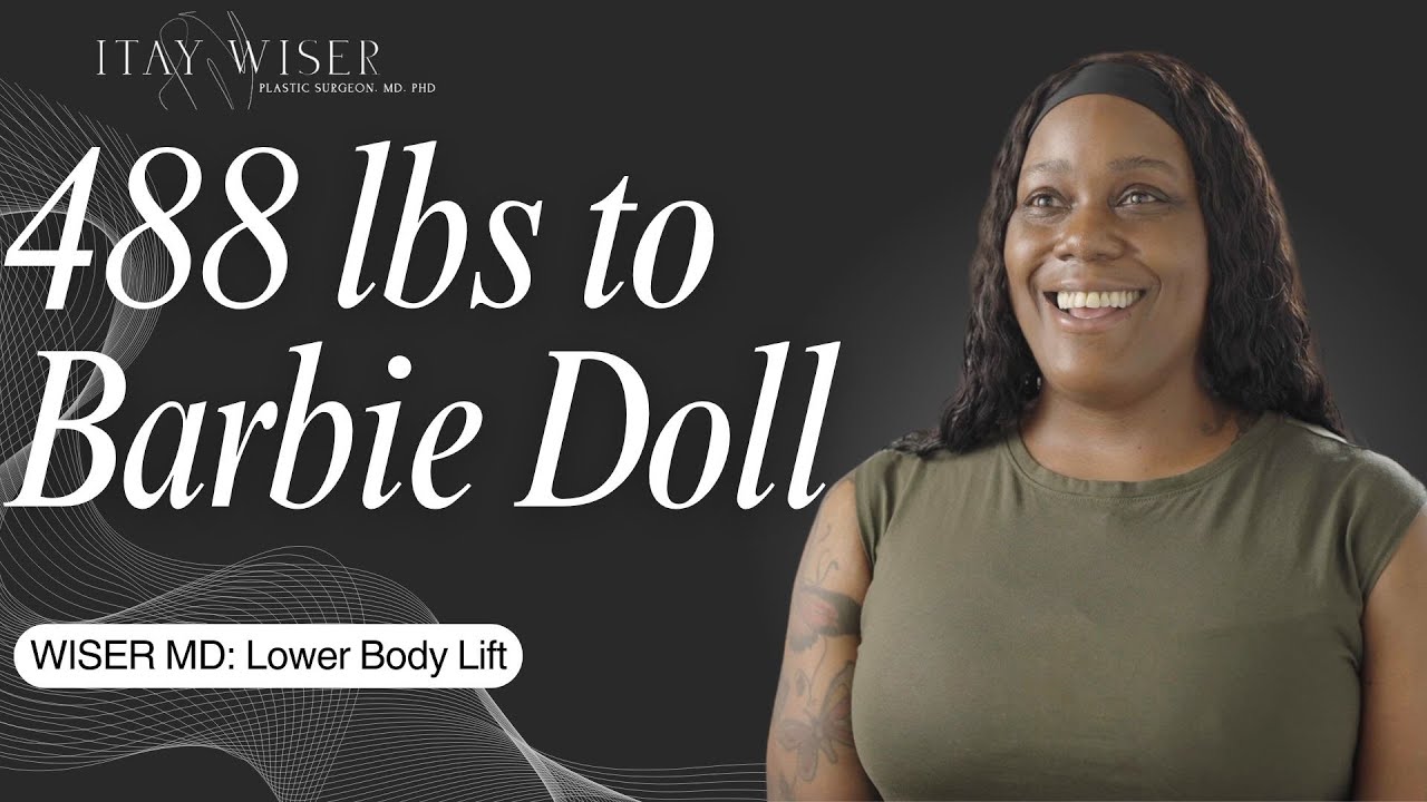 From 488 Pounds to Barbie Doll: A Stunning Transformation - YouTube