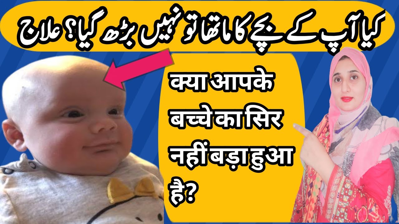 Problem of prominent forehead in baby | The Secret Behind Babies' Head ...