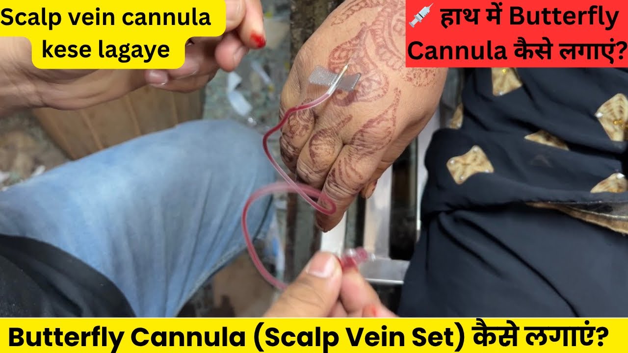 Butterfly Cannula (Scalp Vein Set) कैसे लगाएं? | Step by Step Butterfly ...