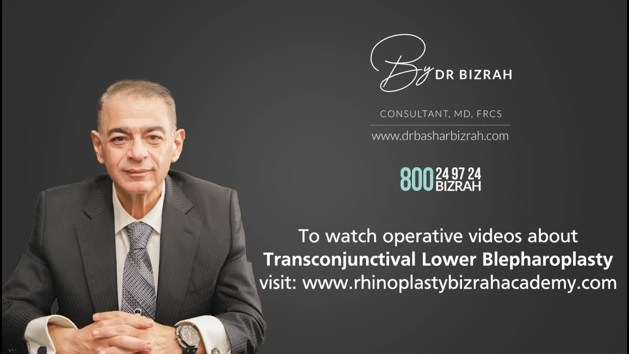 Blepharoplasty Bizrah Masterclass-12: Transconjunctival Lower ...