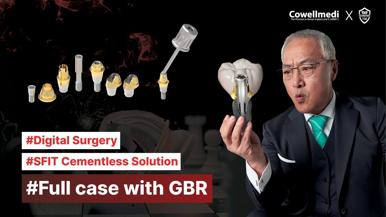 Full Case with GBR using Lodestar Plus Kit - YouTube