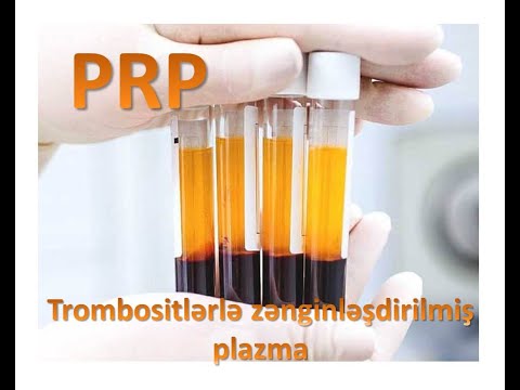 PRP.Platelles rich plazma.Plazmaterapiya.Mezoterapiya