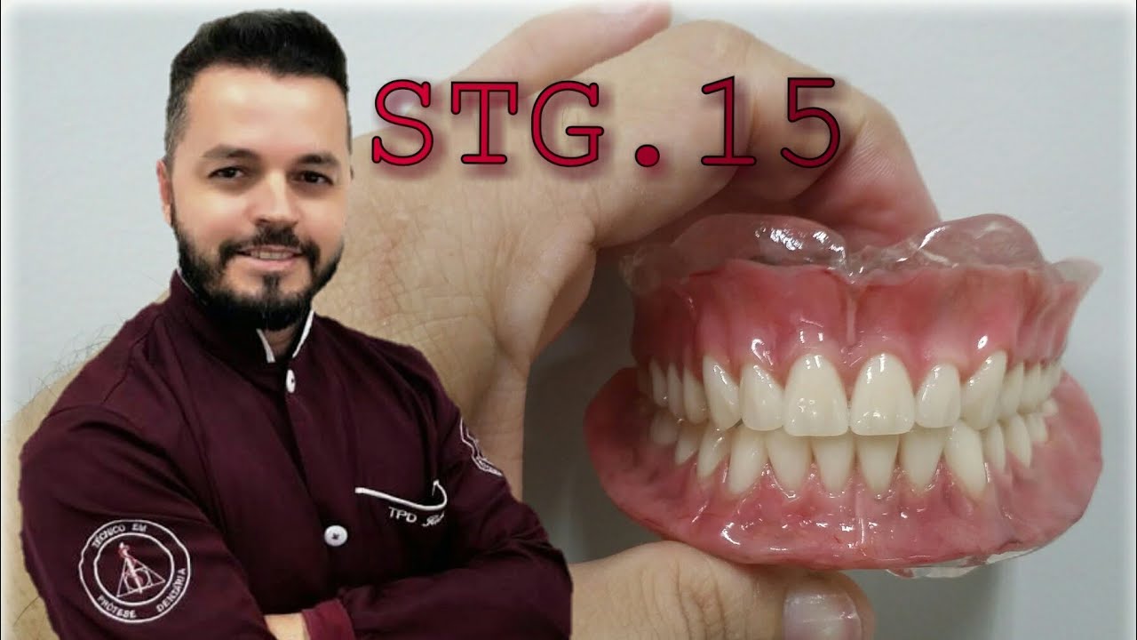 Stg/ acrilizando uma stg 15 - YouTube