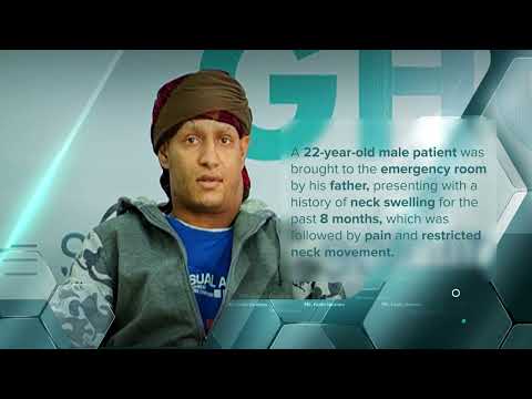 Ibrahim journey from Yemen | Successful Nasopharynx Cancer Treatment at ...