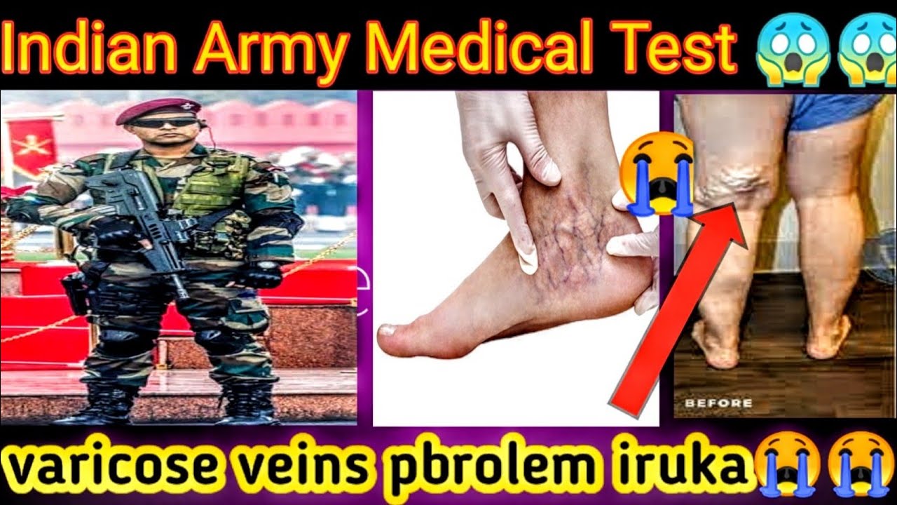 Indian army medical test explained in Tamil|| Indian army medical test ...