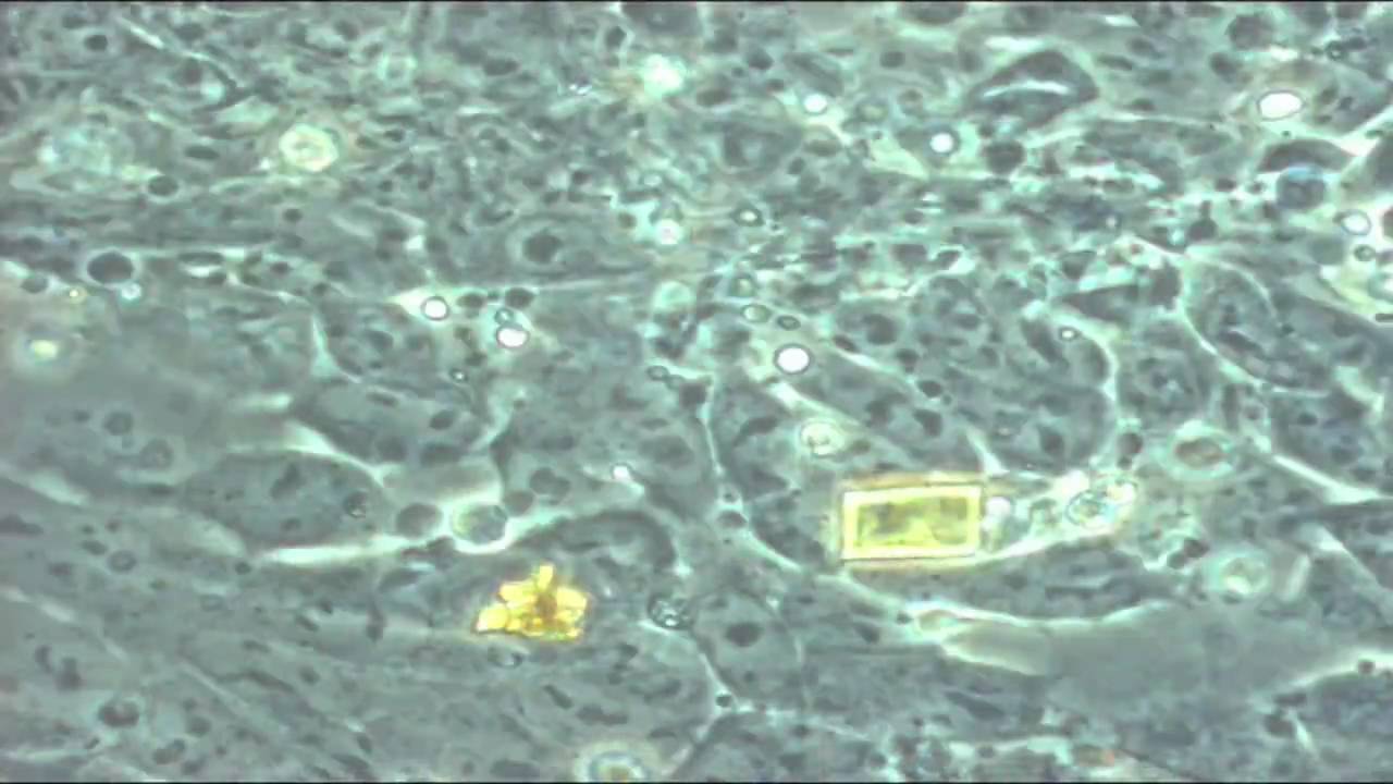 The Unseen I Videos from the Microscope Imaging Station I Exploratorium ...