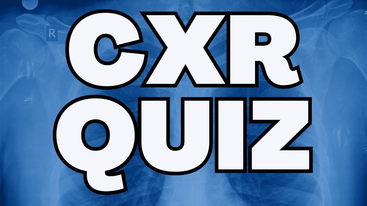 Chest X-ray Quiz Collection - YouTube