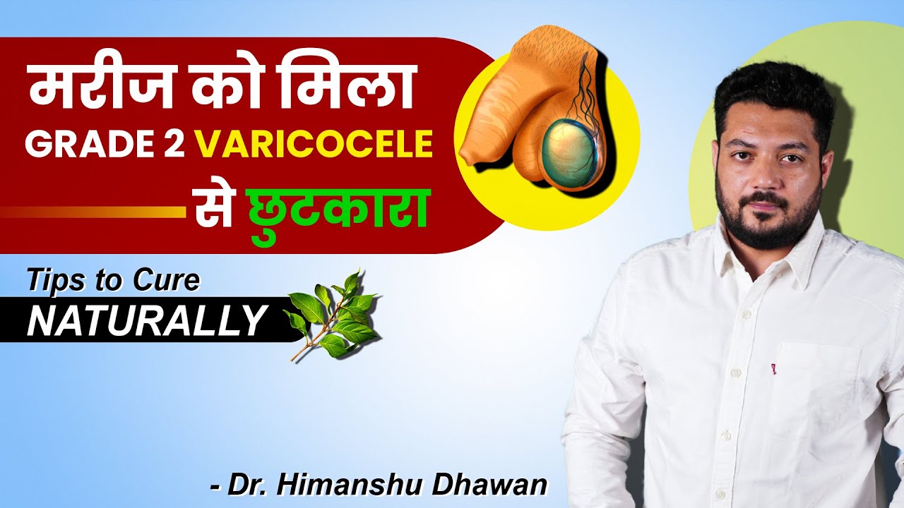 Grade 2 Varicocele का सफल इलाज | Tips to Cure Varicocele | Dr. Himanshu ...