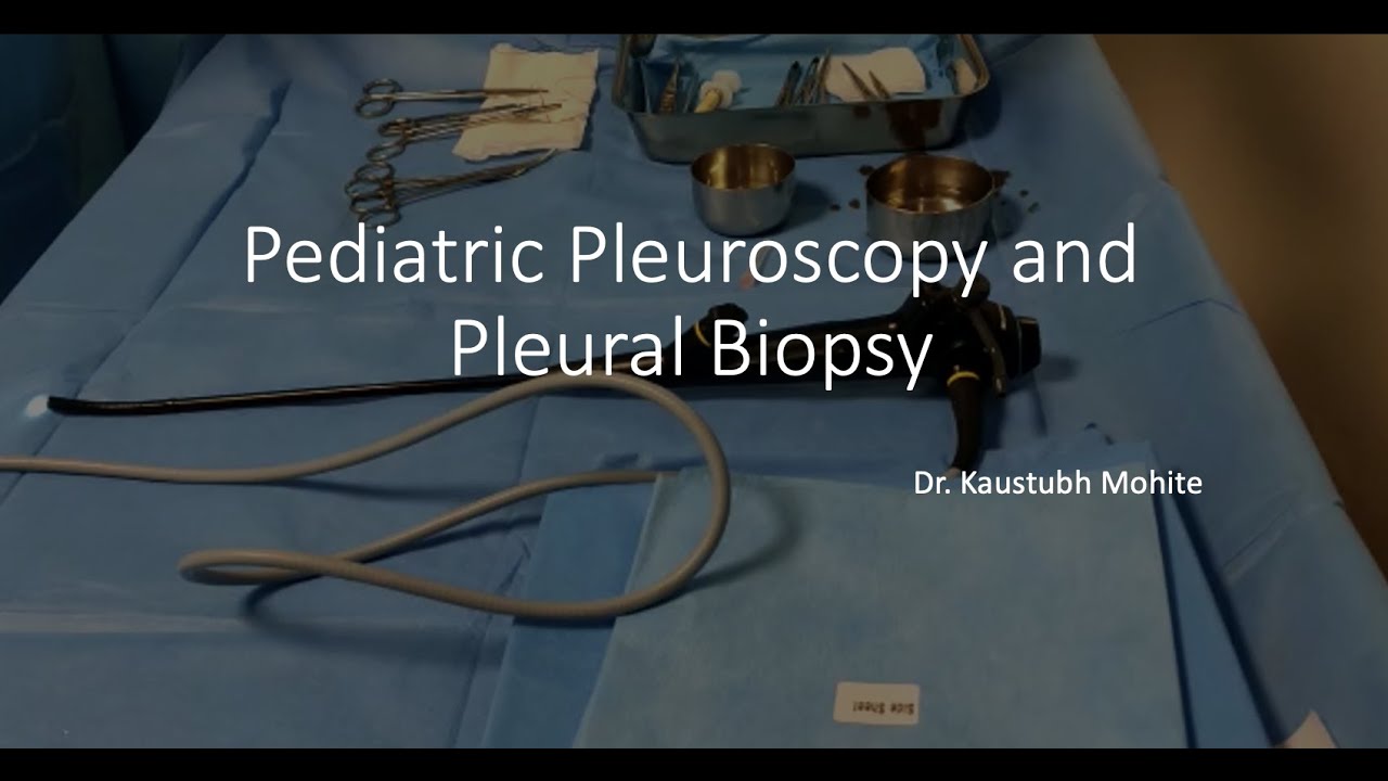 Pediatric Pleuroscopy and Pleural biopsy in diagnosing Tuberculosis ...