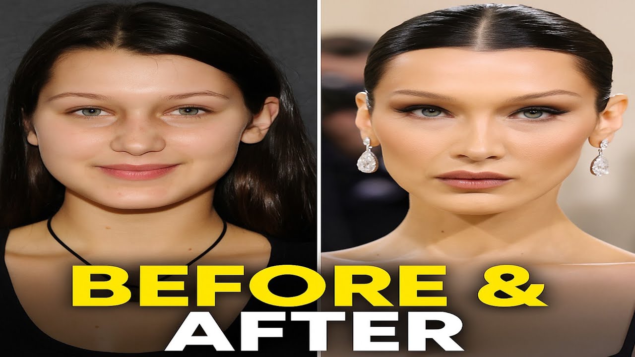 Bella Hadid Before and After Plastic Surgery | Then vs Now Transformation - YouTube
