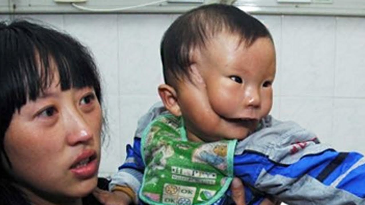 Real Kids Born with Unbelievable Incredible Features! - YouTube