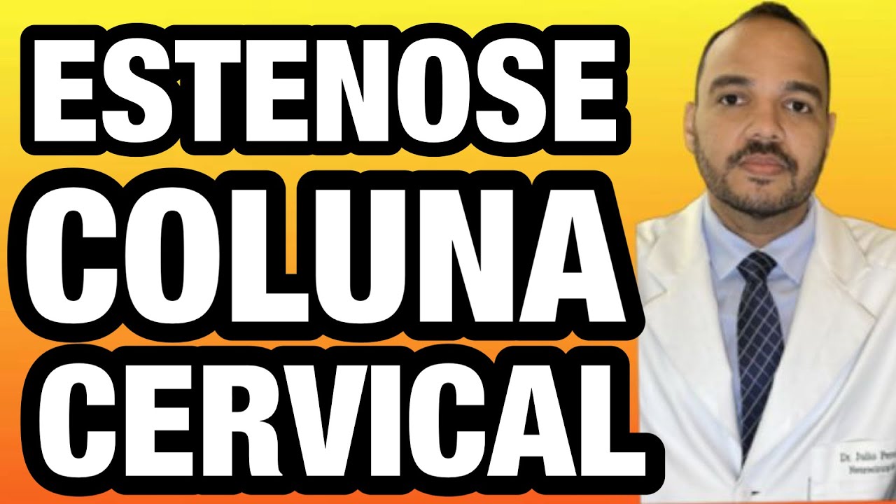 Estenose da coluna CERVICAL: O que é canal estreito lombar? - YouTube