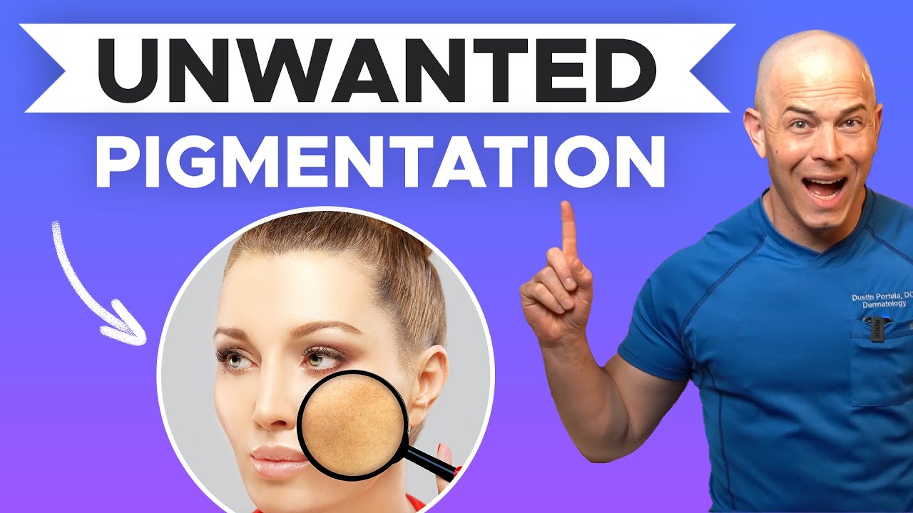 Skin Discoloration Treatment Tips | How To Get Rid Of Hyperpigmentation ...