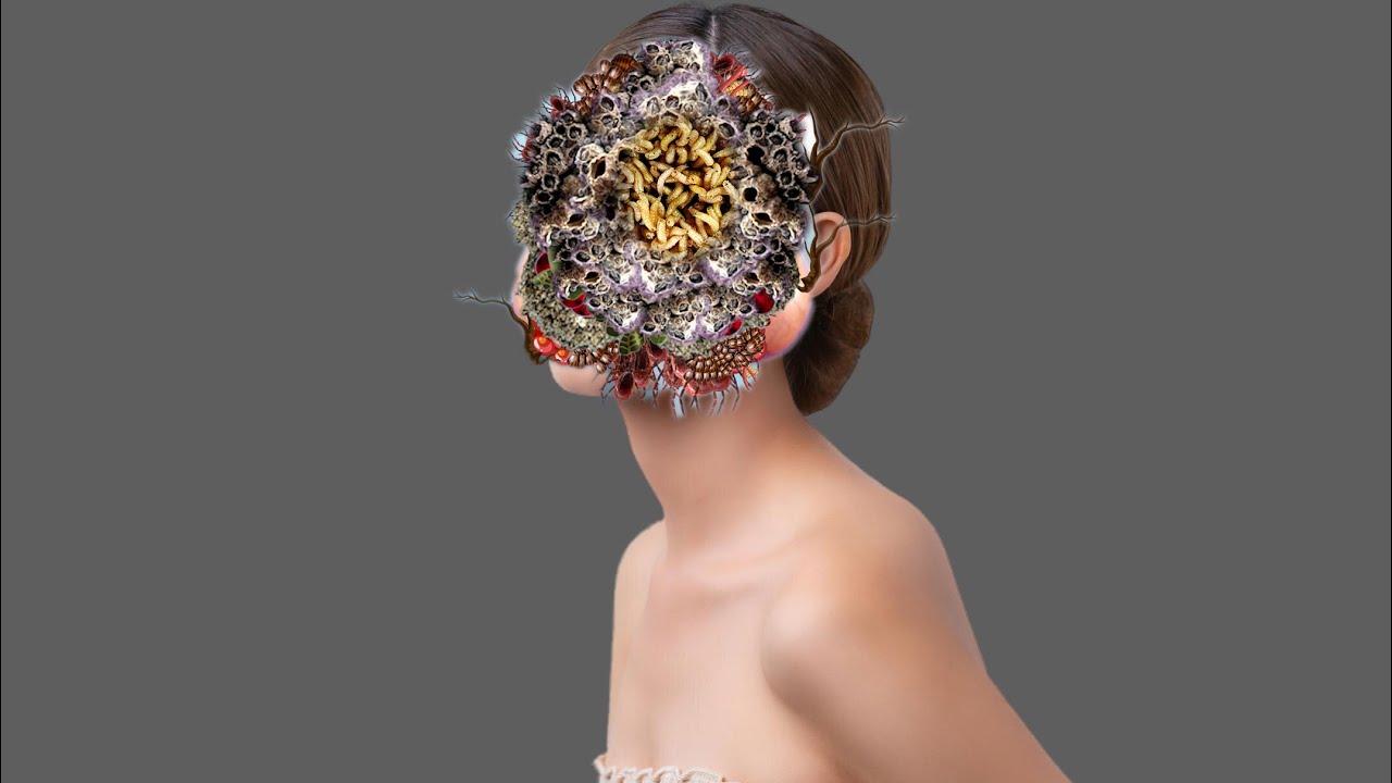 Surgeon Simulator 2 - ASMR Removes Large Pustules & Parasitic Maggots ...