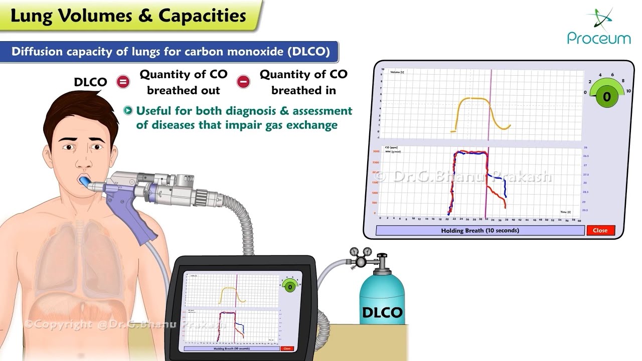 Lung Volumes & Capacities (Animation): 🫁 Respiratory Physiology 🌬️ ...