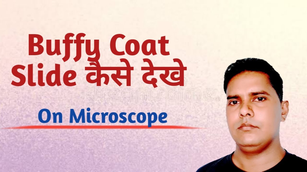 Buffy Coat Slide कैसे देखे | Buffy coat | Buffy coat smear - YouTube
