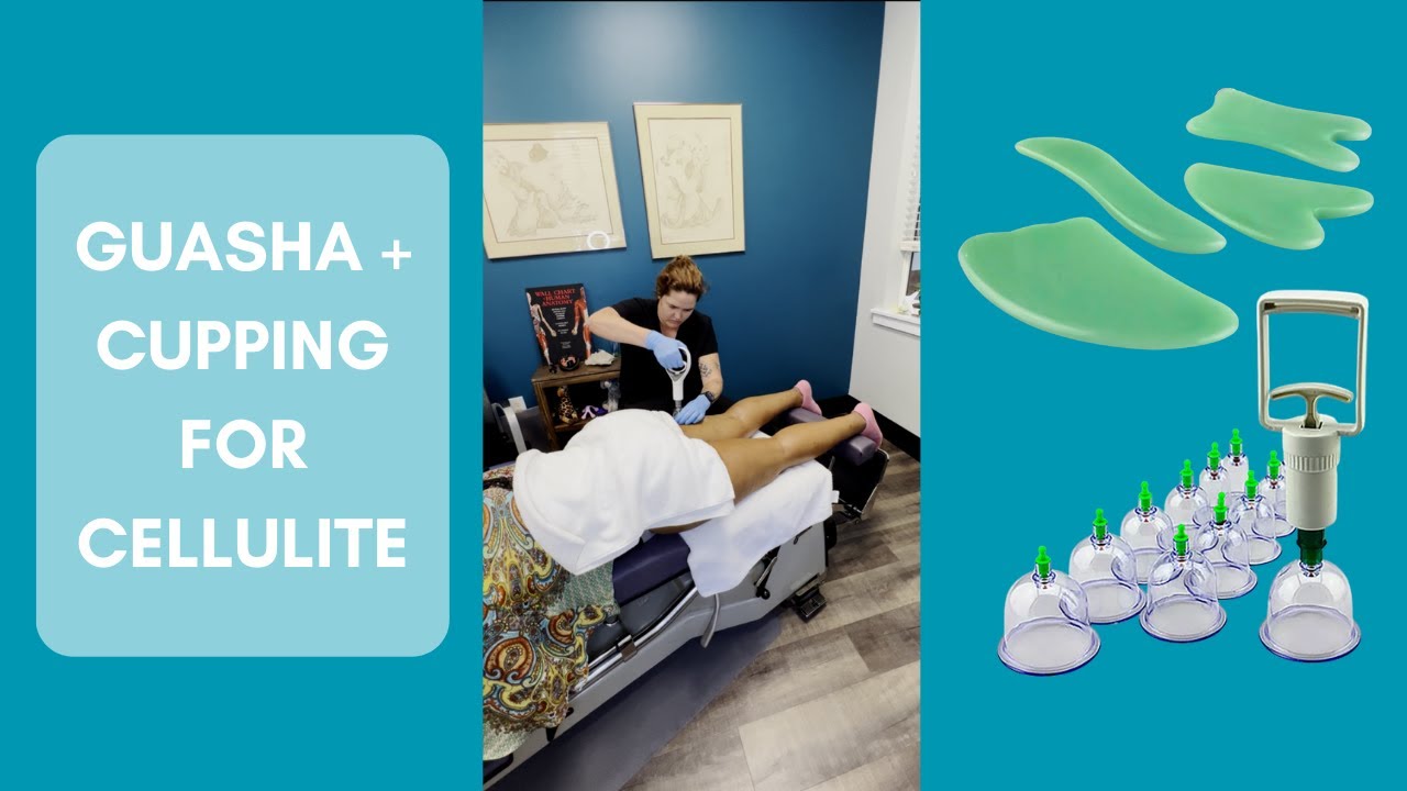 CUPPING + GUASHA Helps Patient's Cellulite and Scar Tissue - YouTube