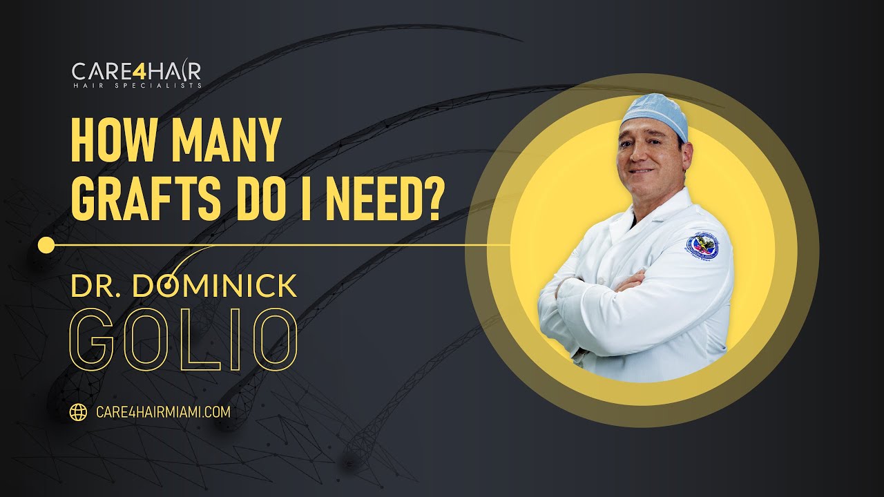 Care4Hair en Miami Florida , El Dr Dominick Golio. ¿Cuántos injertos ...