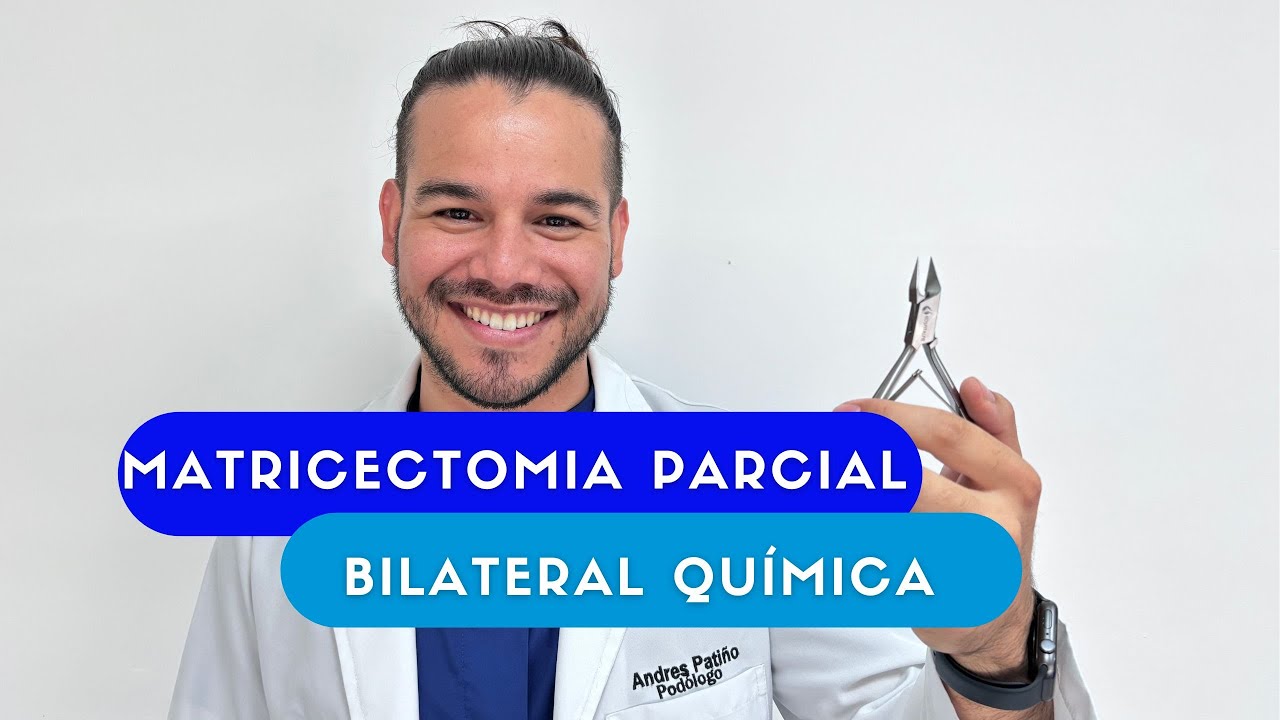 Matricectomía química por onicocriptosis recurrente - YouTube