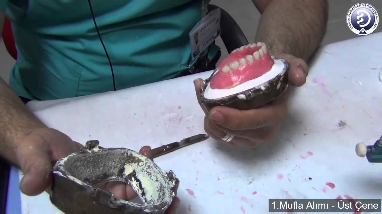 Total Protez - Mufla Aşaması, Mufla Alımı - YouTube