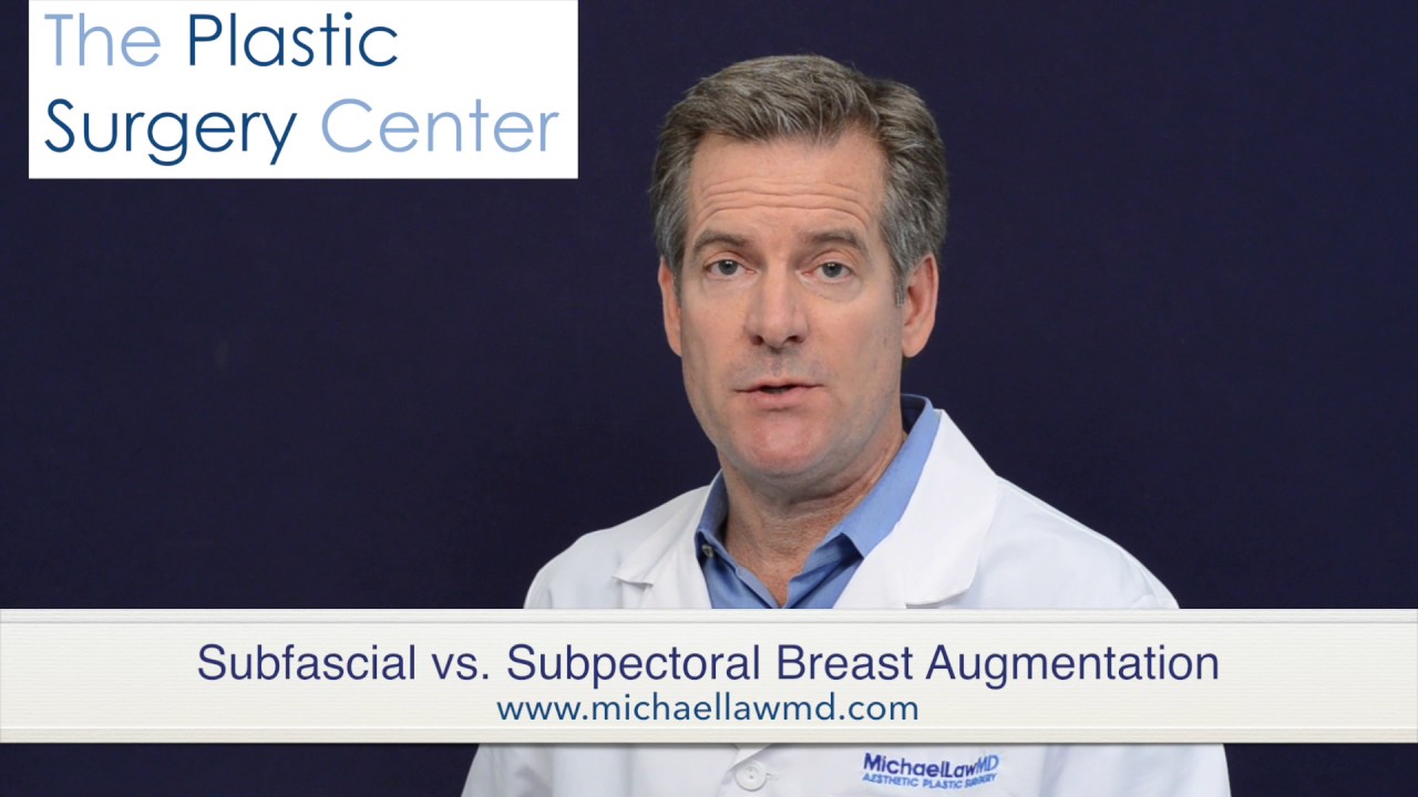Subfascial vs. Subpectoral Breast Augmentation - YouTube