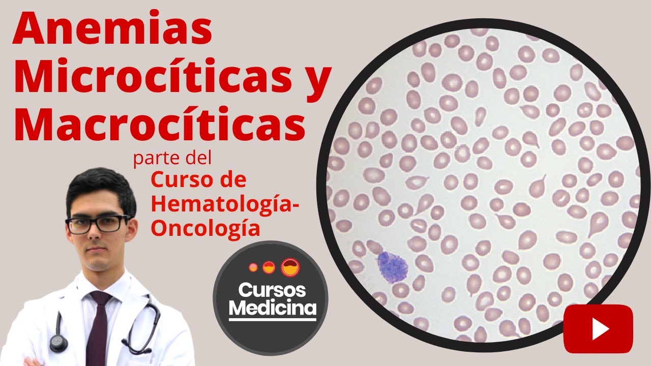 Anemias Microcíticas y Macrocíticas - Curso de Hematología-Oncología ...