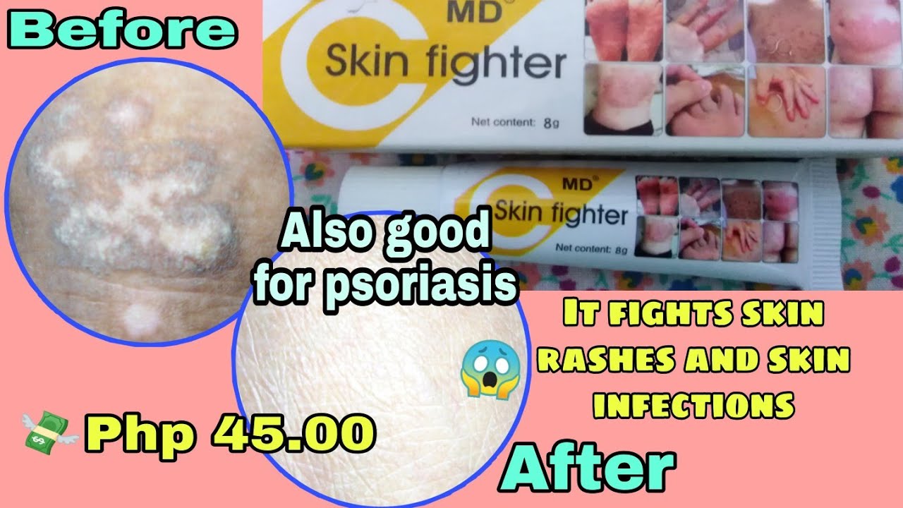 Skin Fighter Review| Khirsten Ann - YouTube