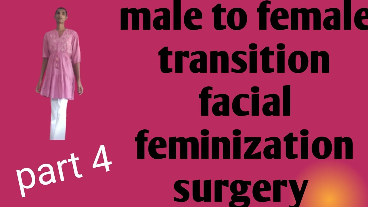 male to female transition facial feminization surgery - YouTube