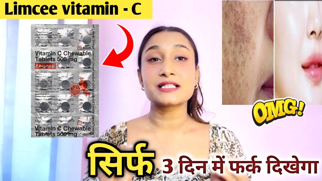Limcee Vitamin C Benefits For Skin Limcee Tablet Ke Fayde Limcee Side limcee-vitamin-c-benefits-for-skin-limcee-tablet-ke-fayde-limcee-side