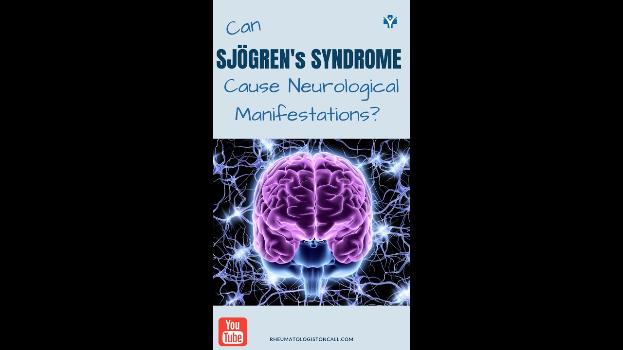 How can Sjogren's Syndrome affects your brain and peripheral nervous ...