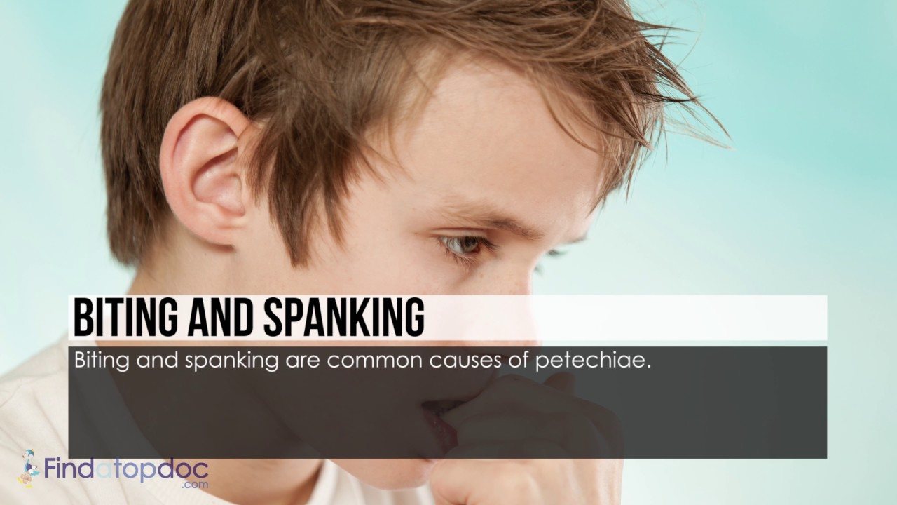 What Is Petechiae? - YouTube