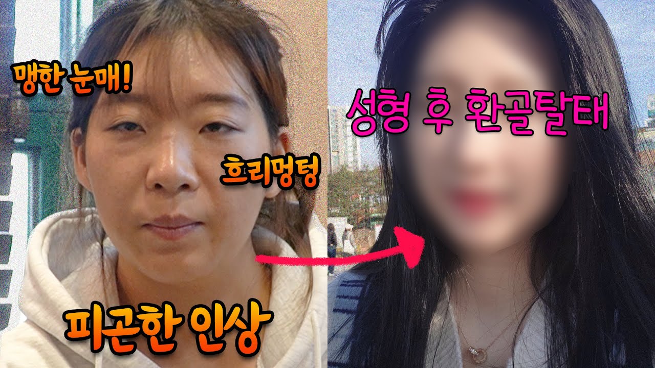 이 여자 성형 대박이노 리그 오브 레전드 갤러리
