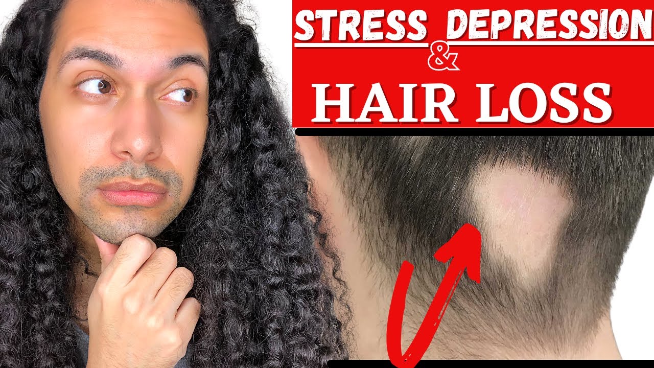 How I overcame hair loss linked to depression - YouTube