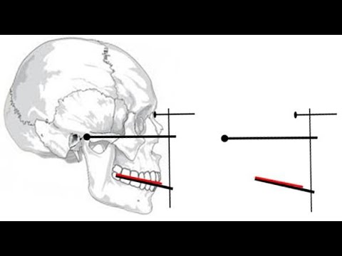 Orientation jaw relation made easy. Why we record orientation jaw ...