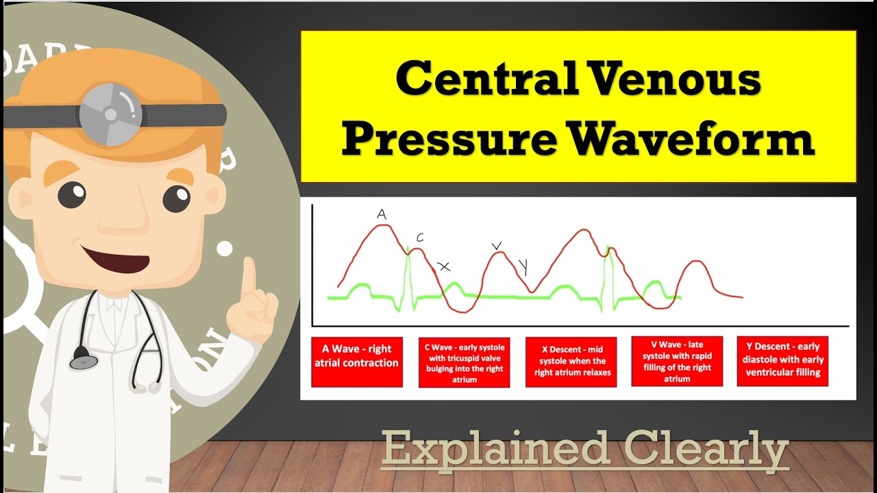 Central Venous Pressure CVP Waveform And Tracing Basics A C X V central-venous-pressure-cvp-waveform-and-tracing-basics-a-c-x-v