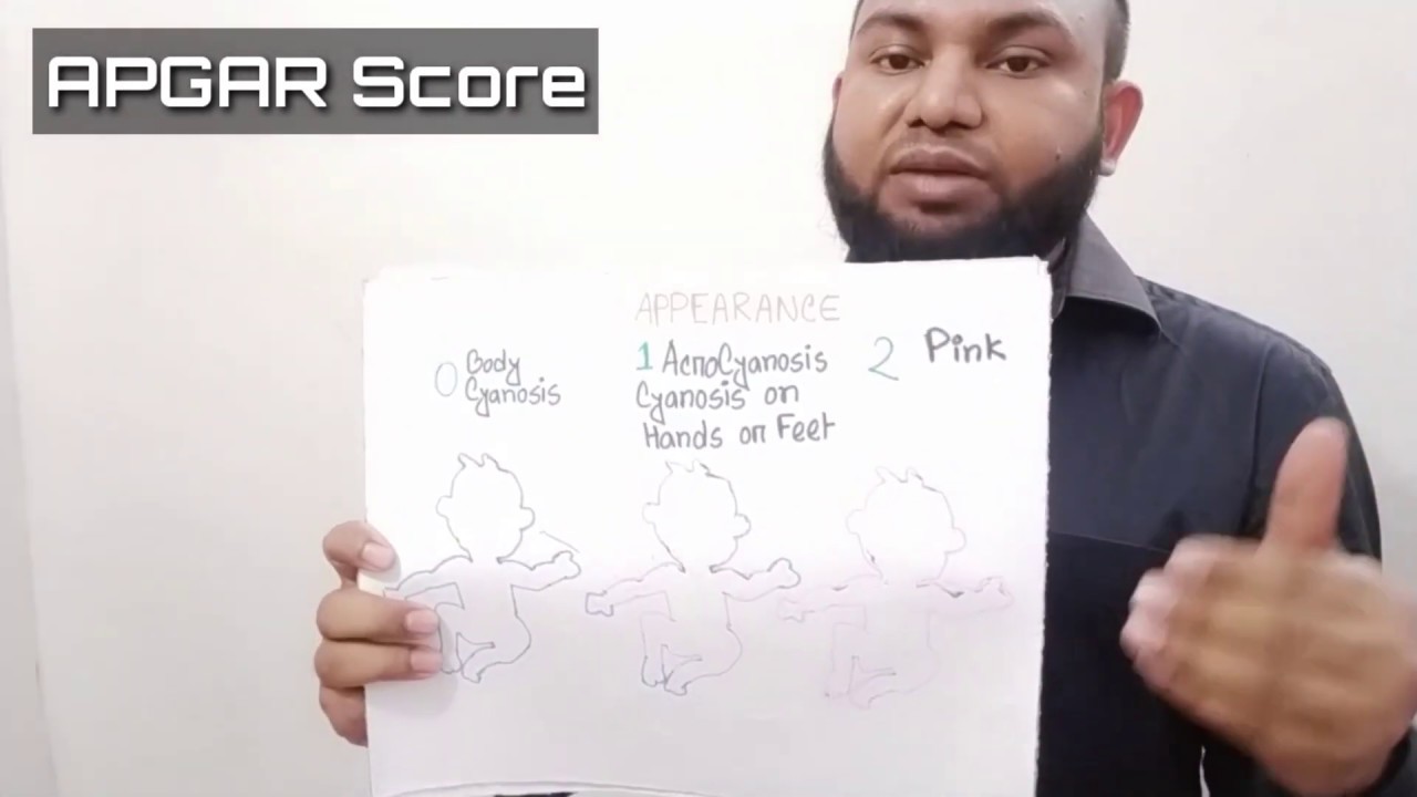 APGAR Newborn Assessment Score .the best explanation with a mnemonic ...