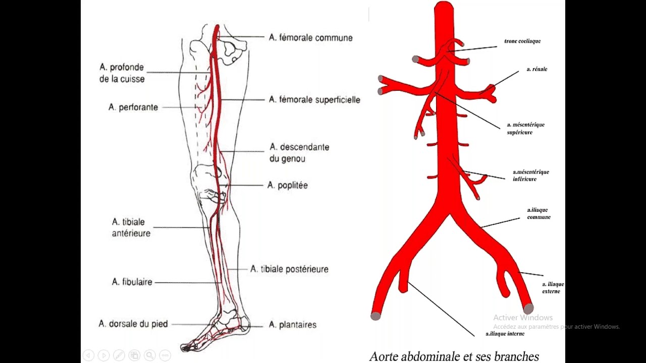 Ischémie arterielle aigue du membre inférieur ( Dr. LAKHAL ) - YouTube