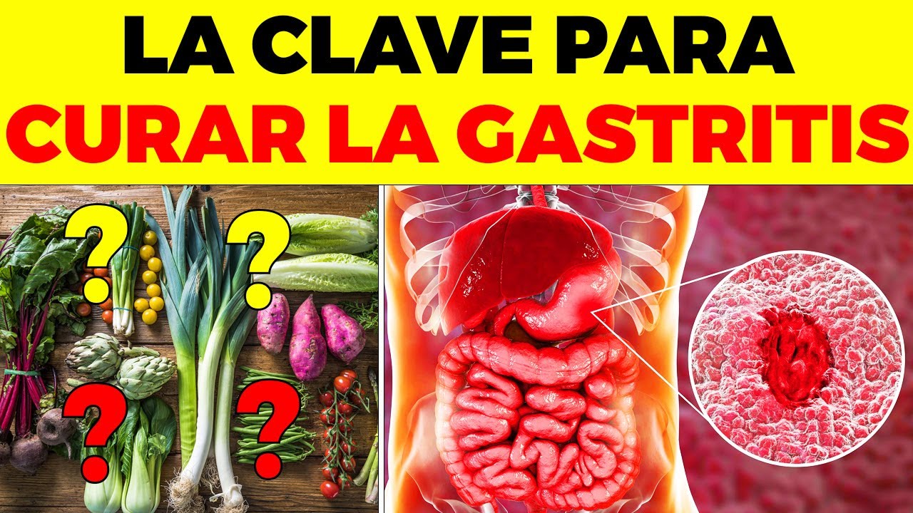 Esta Es El Mejor Alimento Para La Gastritis Habitos Buenos Para La Gastritis Youtube
